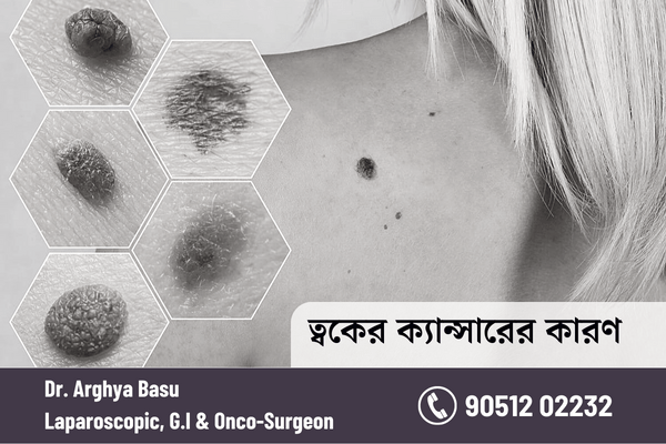 Causes of skin cancer and preventive measures - Dr. Arghya Basu